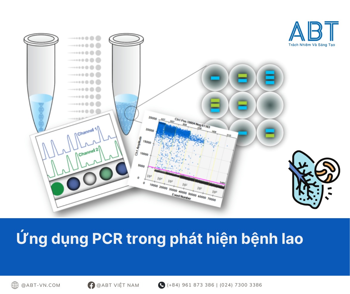Ứng dụng PCR trong phát hiện bệnh lao